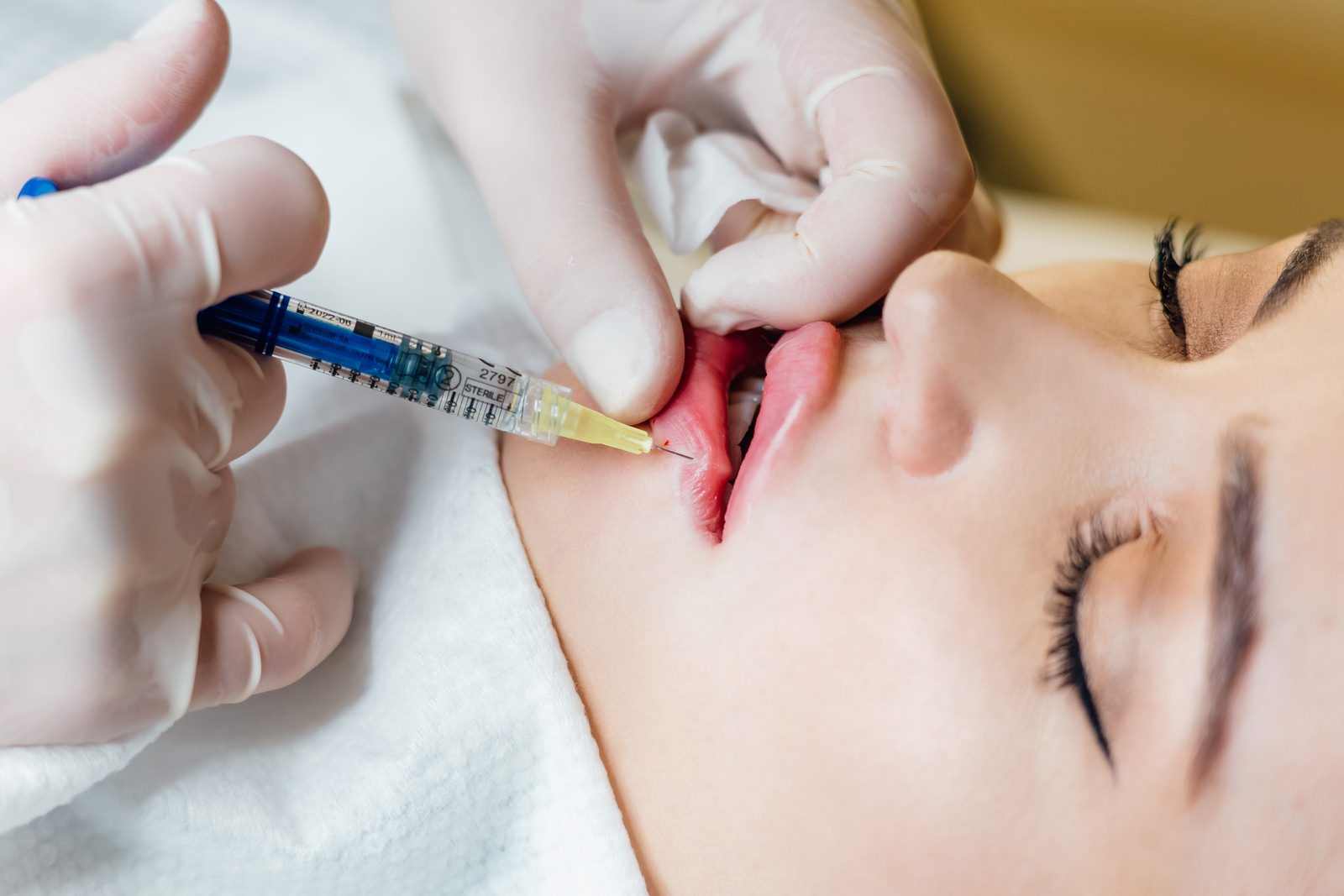 Enhancing Natural Beauty: Lip Augmentation at Toronto Dermaplastics ...
